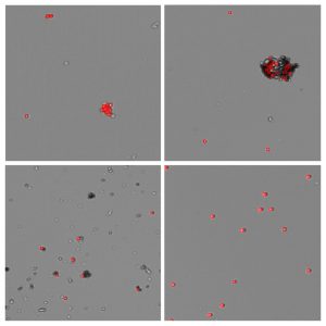 Counting Algae Cells | Technical Note 222